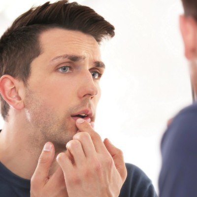 Education for Scar, Stretch Marks & Cold Sores | Mederma®